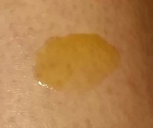 Zen Healing Balm from Zenith Herbal