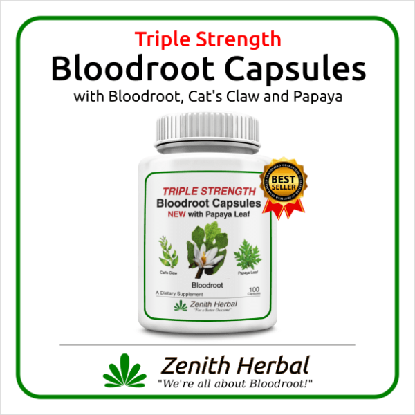 Shop for Bloodroot Salve and Capsules