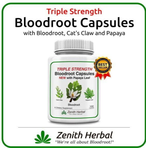 Ichthammol Ointment for Boils: A Comprehensive Guide | Zenith Herbal